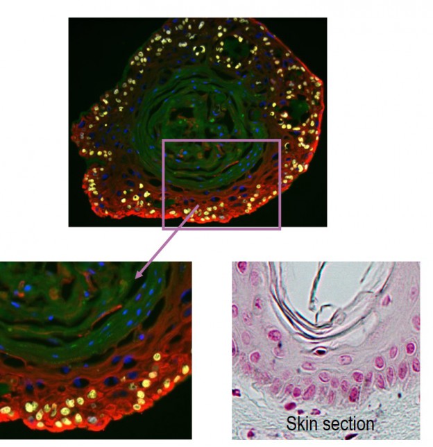 New 3D skin model to study inflammatory response - Syntivia