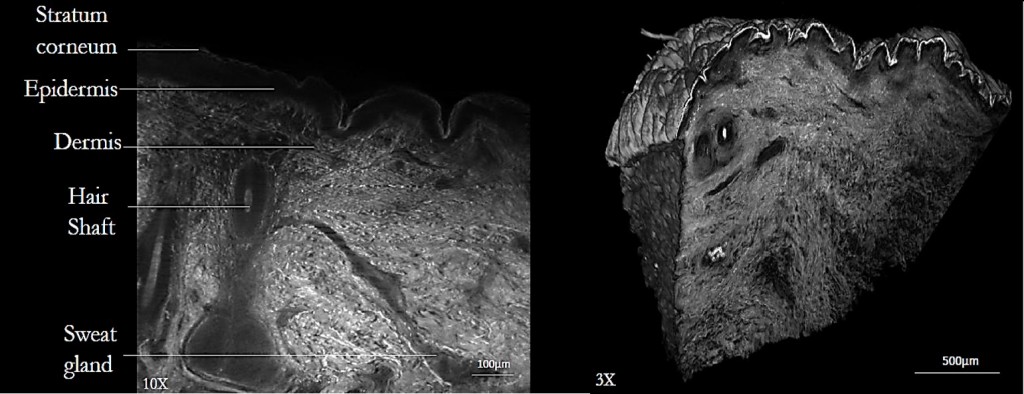Syntivia uses transparent model and hi-tech 3D skin imaging
