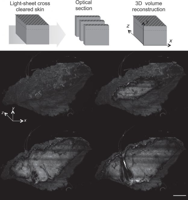 Transparent skin to study cosmetic efficacy in 3D | Syntivia