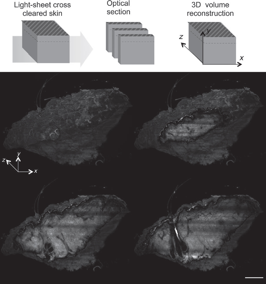 Transparent skin to study cosmetic efficacy in 3D | Syntivia