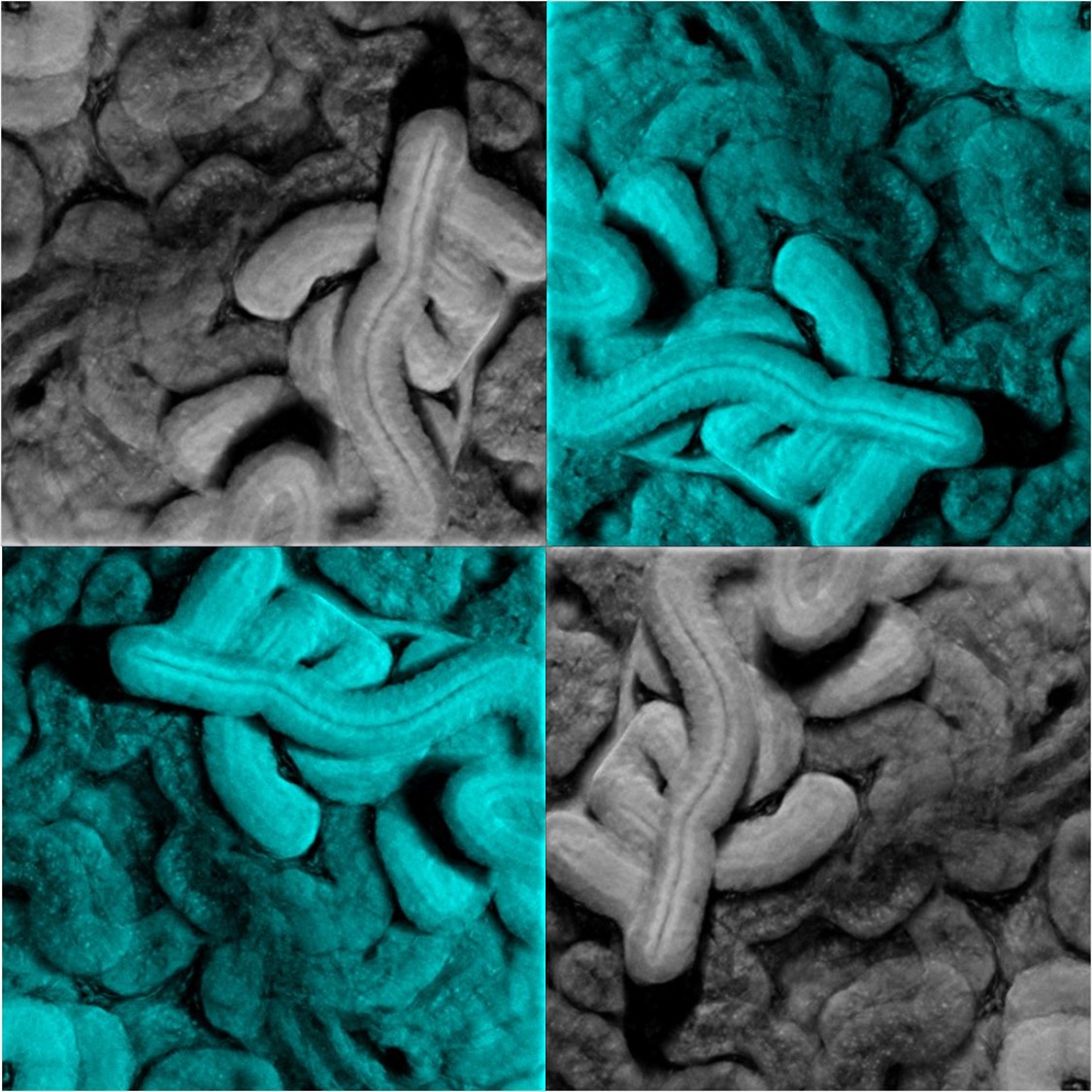 High resolution skin imaging for cosmetic claims | Syntivia