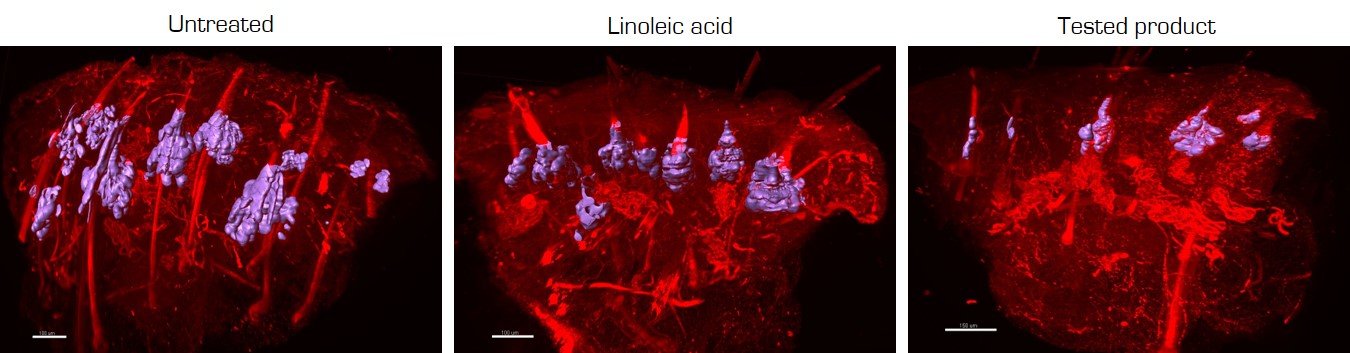 Ex vivo sebaceous gland studies for cosmetics | Syntivia