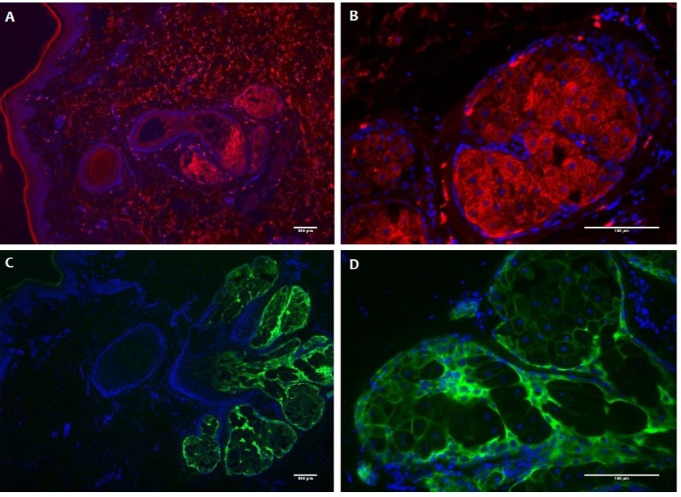 Ex vivo sebaceous gland studies for cosmetics | Syntivia