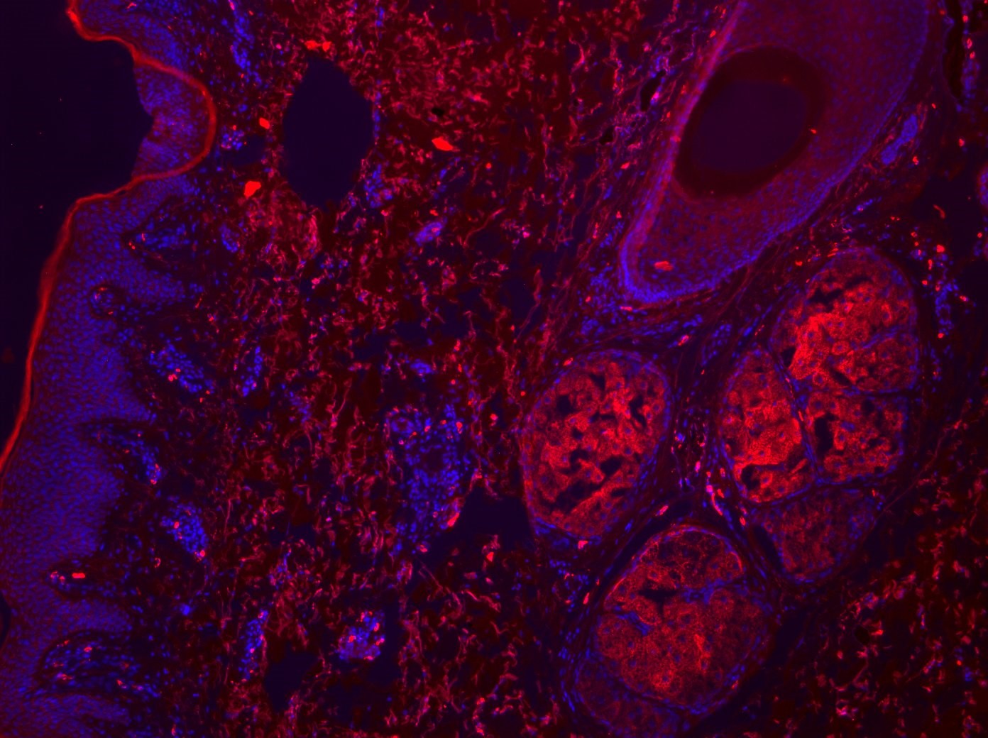 Ex vivo sebaceous gland studies for cosmetics | Syntivia