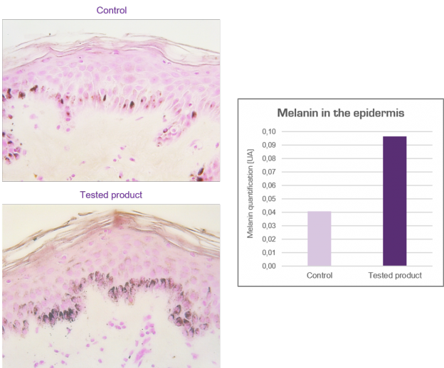 Skin pigmentation studies for cosmetics | Syntivia