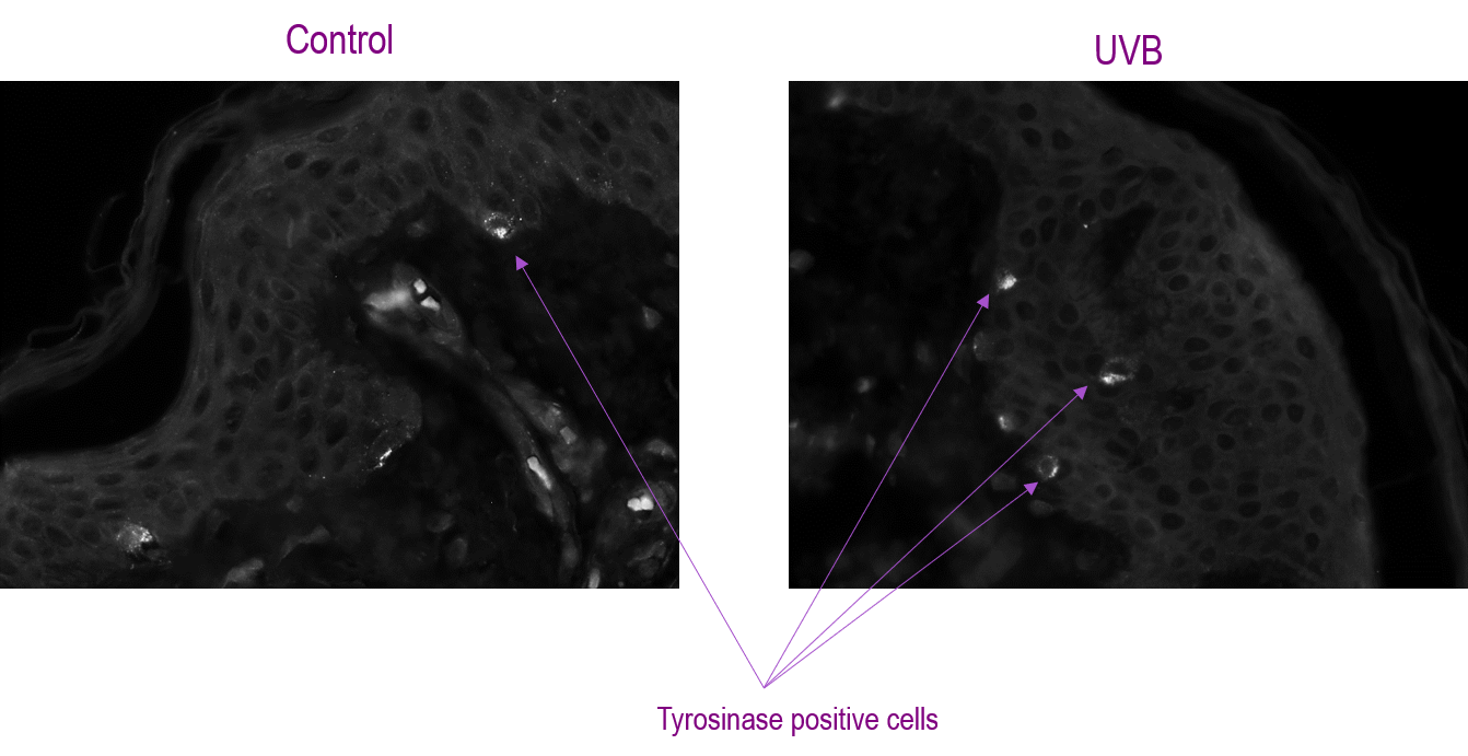 Skin pigmentation studies for cosmetics | Syntivia