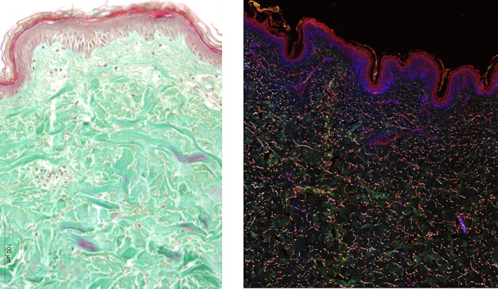 VIRUS ON THE SKIN - Syntivia