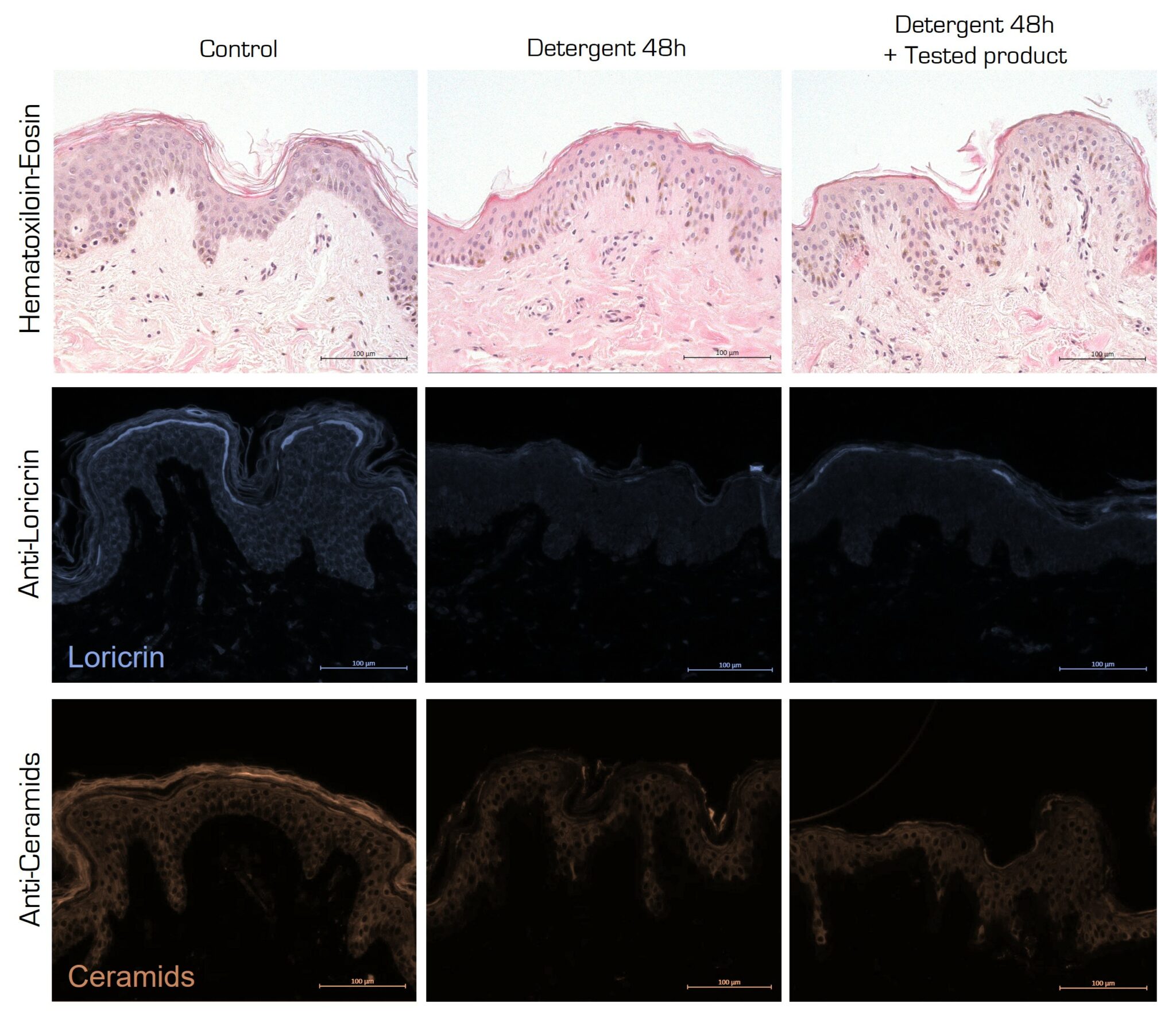 Tissue regeneration on ex vivo human skin model - Syntivia